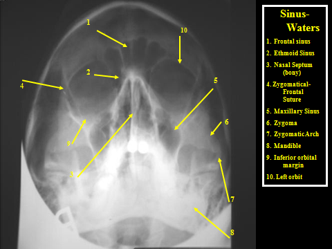 Dentistry and Medicine: Head and Neck Radiology-How to Identify ...