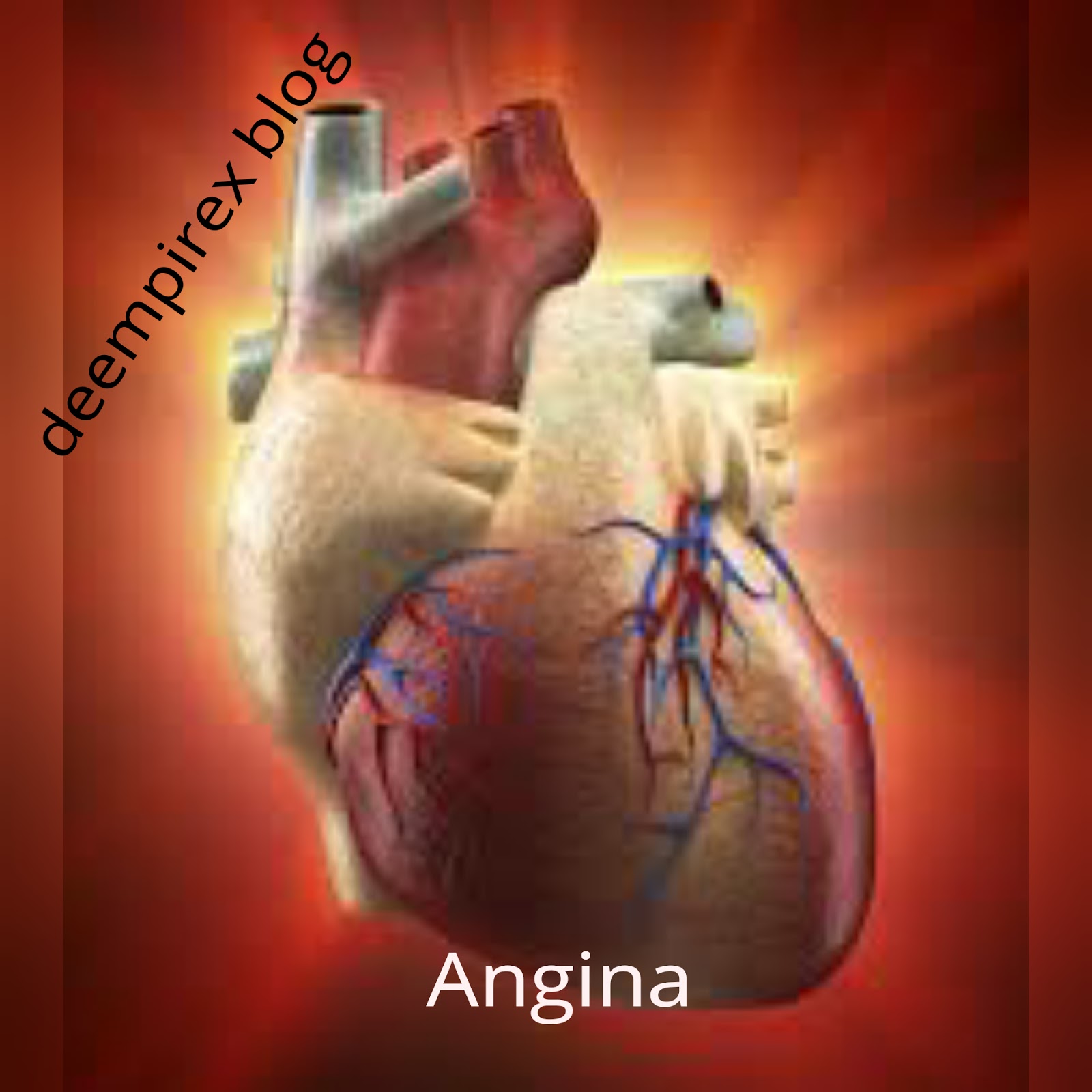 Angina Pectoris Welcome To The Empire angina-pectoris-welcome-to-the-empire