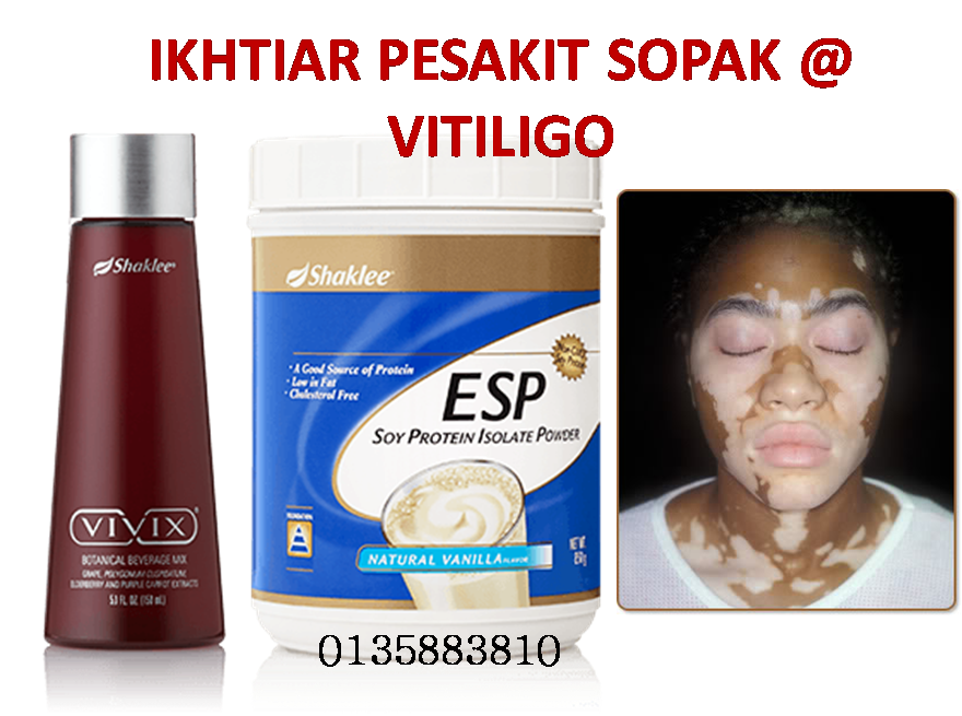 Bagaimana Merawat Penyakit Sopak @ Vitiligo Secara Selamat | VITAMIN ...