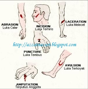 nursing care moslem: Wound Care