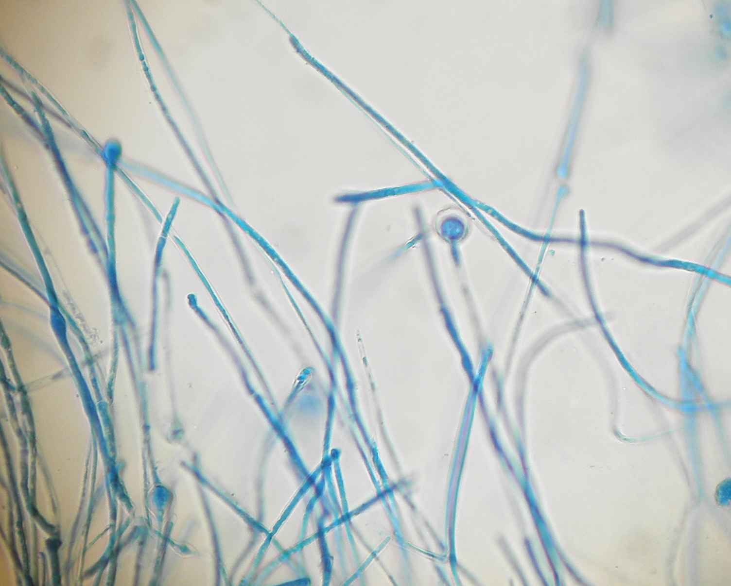 ATLAS MICOLOGIA: MICROSPORUM AUDOUINII