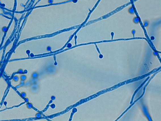 Fun With Microbiology (What's Buggin' You?): Blastomyces dermatitidis