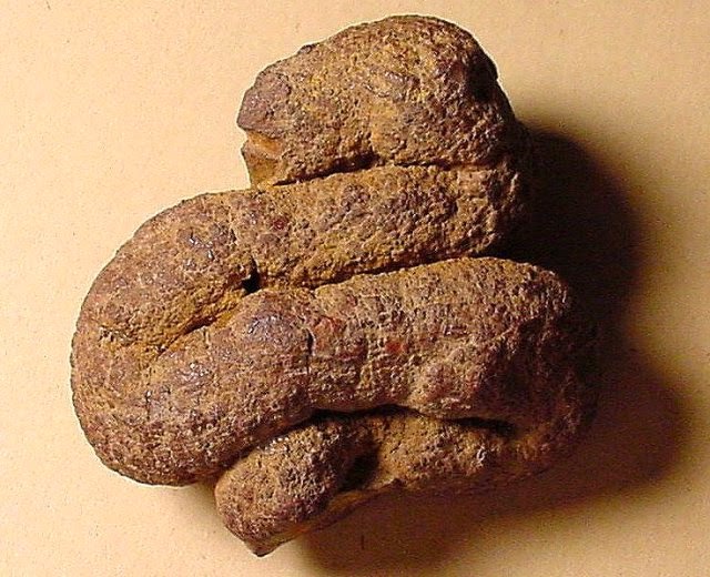 The Body Blog: Tales from the Poo...