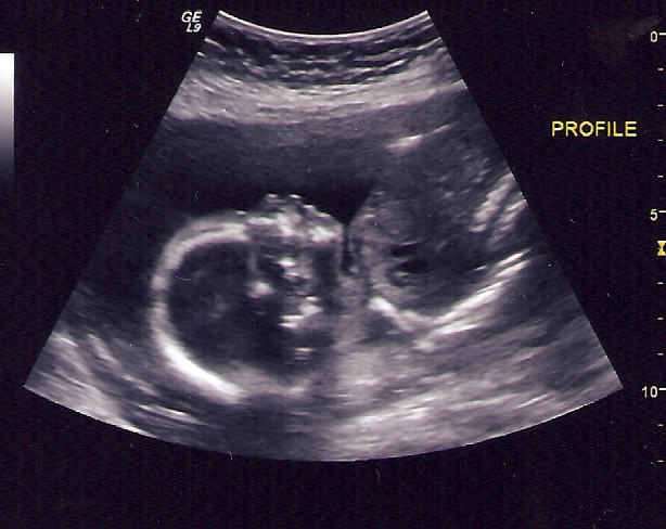 Crikey! There's a bun in my oven!: The Birth of Cyan