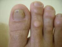 Atendimentos Podológicos | Bassi Podologia