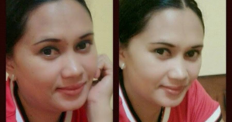 AJAIB TUHANKU: Shinta Supit: 24 Dokter Spesialis menyatakan tidak bisa ...