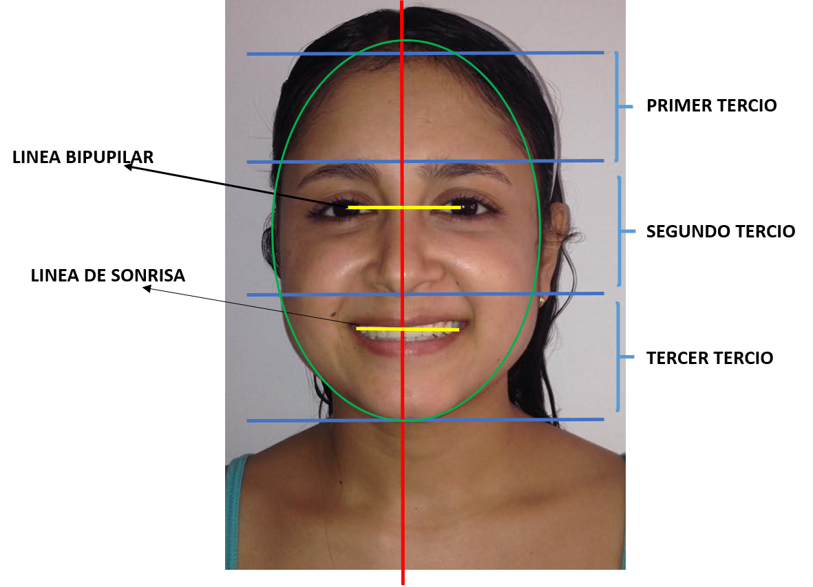 Introducción a la Odontología 2015-ll: ANÁLISIS DE SONRISA