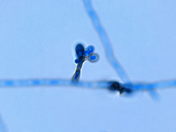 Fun With Microbiology (What's Buggin' You?): Ochroconis species