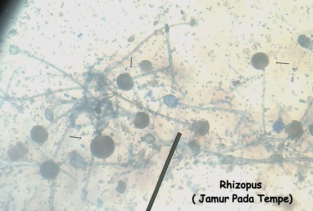 Rizqi Murtafi'ah: Jamur Pada Tempe