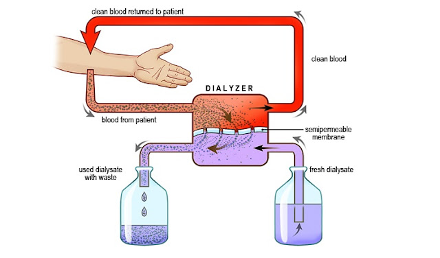 Idea for today: I Wonder #2 How Do Kidney Machines Work?