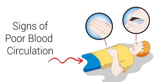 8 Warning Signs of Poor Blood Circulation