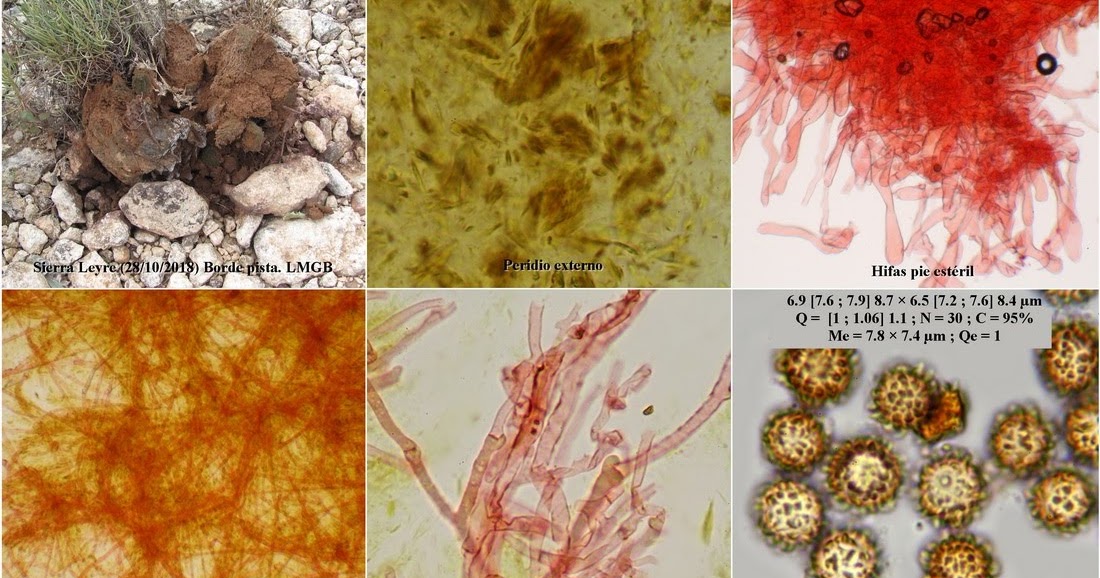 Microscopía de hongos. Vol 4. O - R: Pisolithus arhizus