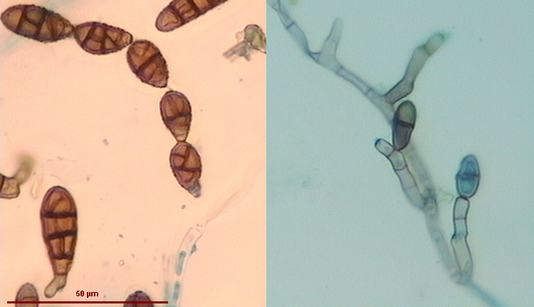 Microbiología y Epidemiología: Alternaria sp - Aspergillus