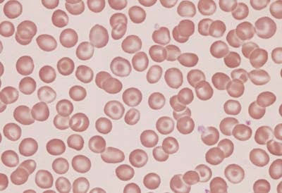 Atlas de Células Sanguíneas