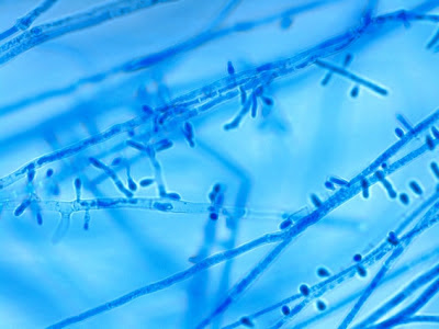 Fun With Microbiology (What's Buggin' You?): September 2012