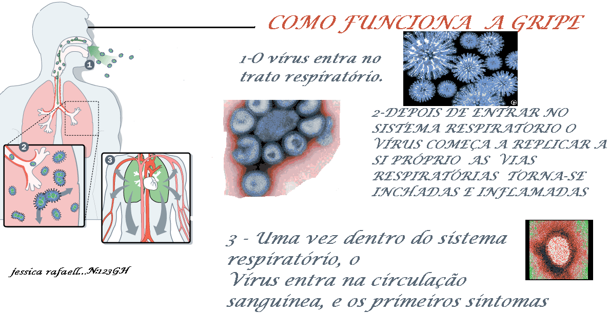 Medicine Online: O que é a gripe?