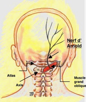 Fisioterapia y Osteopatía : NEURALGIA DE ARNOLD