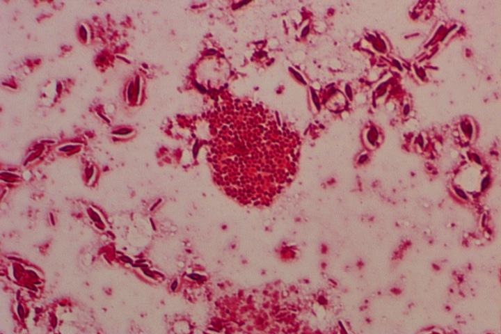 Bee Bugs: The genome of Paenibacillus alvei