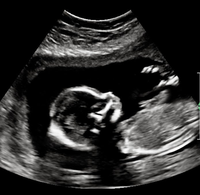 All My Favorites: 19 weeks - Ultrasound #4