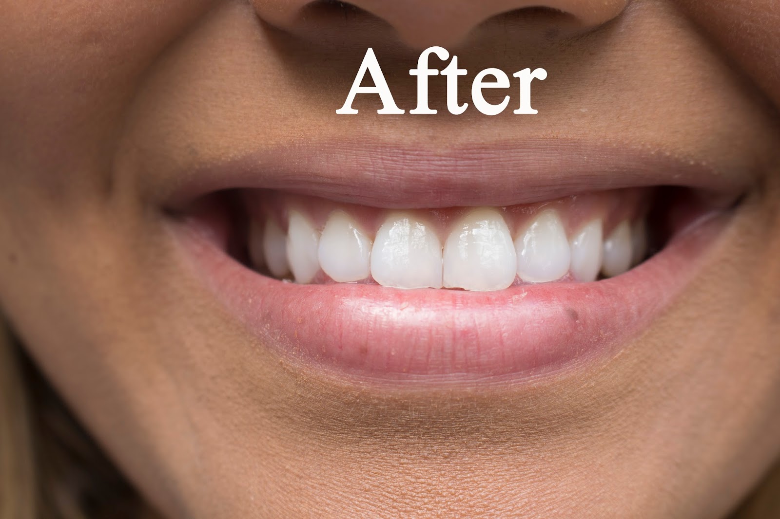 Simply Sovann: At Home Teeth Whitening For Coffee Addict