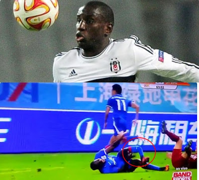 Ex Chelsea FC Striker Demba Ba suffers horrible broken leg in a match ...