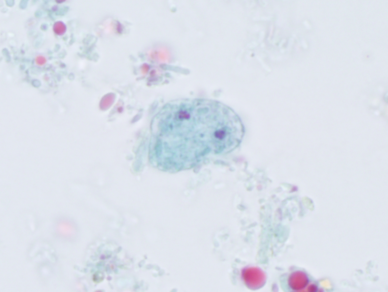 Dientamoeba Fragilis Trichrome