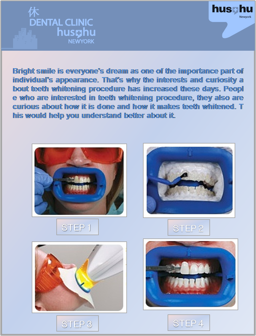 US Certified Dentist: Hus'hu NEWYORK Dental Clinic - Teeth Whitening ...