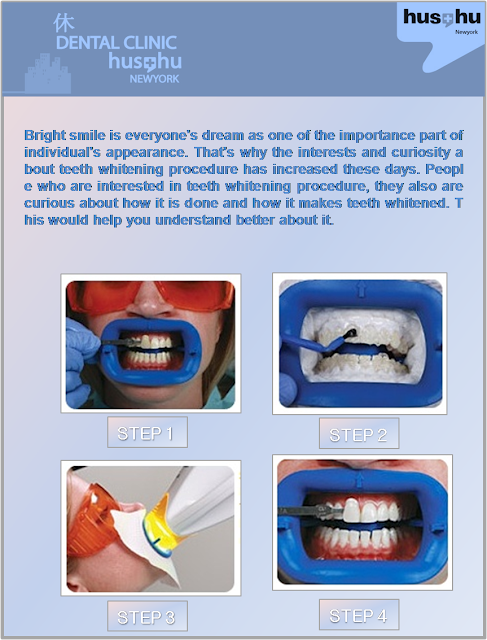 US Certified Dentist: Hus'hu NEWYORK Dental Clinic - Teeth Whitening ...