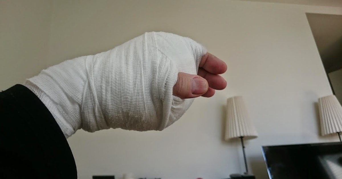 Naruskan Tukikohta: Sormileikit vasurilla vähäks aikaa leikitty.