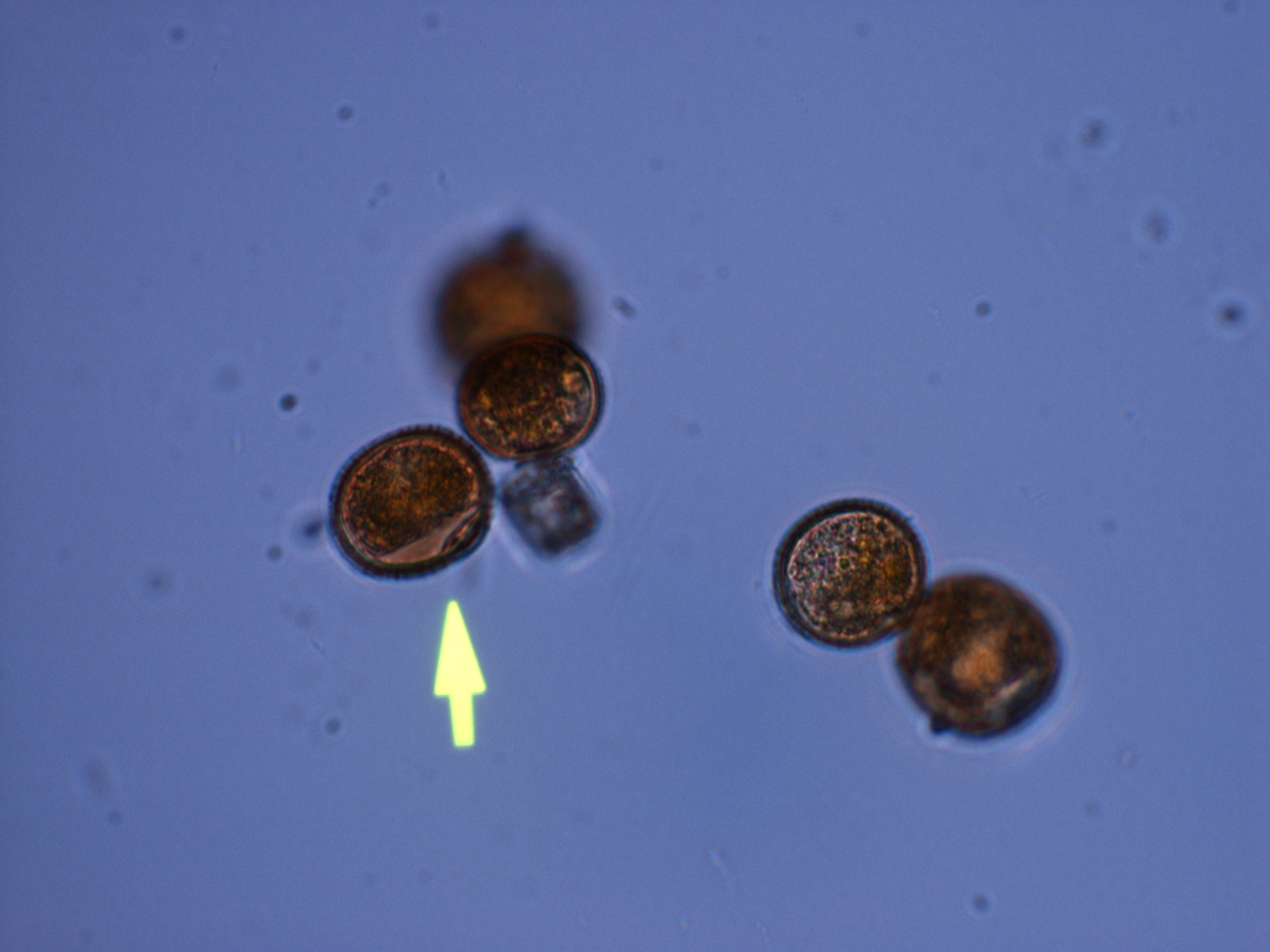University of Illinois Plant Clinic: How We Identify Corn Leaf Diseases ...