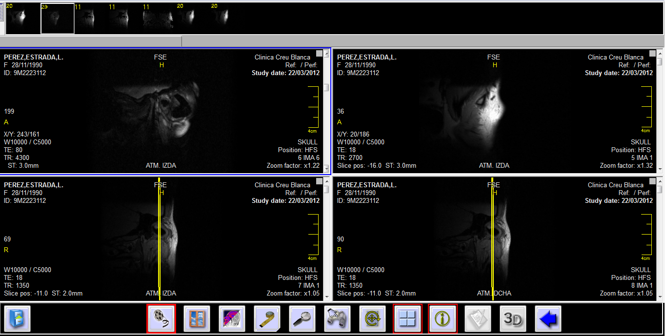 Dentistry: Magnetic resonance imaging of TMJ