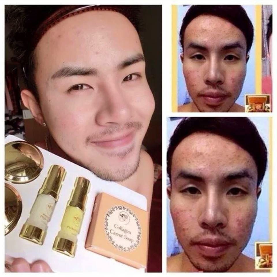 #1 Thailand Skin Whitening Products