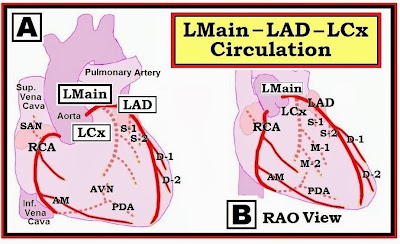 ECG Interpretation: ECG Interpretation Review #82 (Acute STEMI – RCA ...