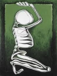 Open-Access Orthopaedics: Prefemoral Fat Pad Impingement Syndrome