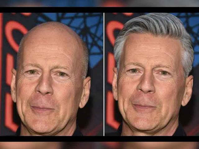 VIEWS LIKE TV: Así se verían estos 11 famosos con pelo. El #11 te hará ...