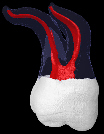 The Root Canal Anatomy Project: Maxillary Second Molar