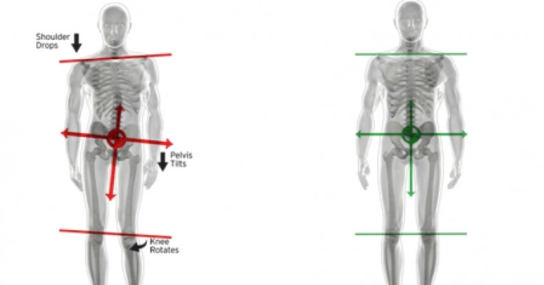Cure Naturali: Solette Propriocettive