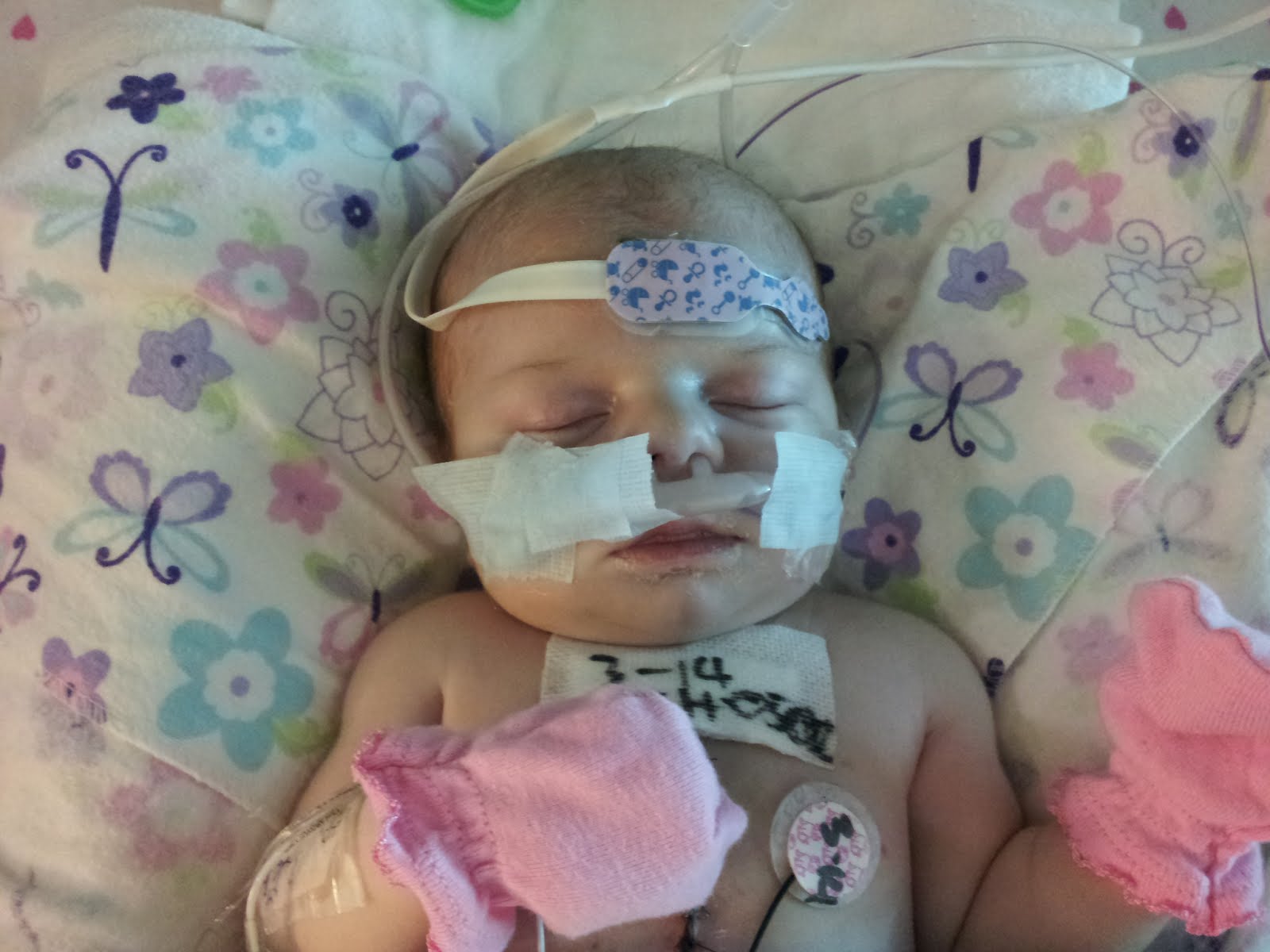 Baby Katherine - Pure of Heart: Katie's Life In Pictures - CVICU: Post ...