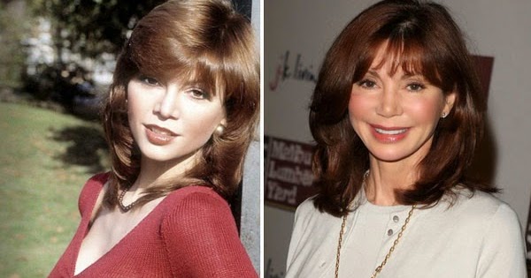 Did Victoria Principal get Plastic Surgery Facelift, Botox Injections ...