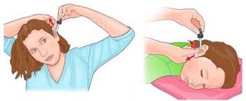 ADMINISTRACIÓN DE MEDICAMENTOS: VÍA OTICA