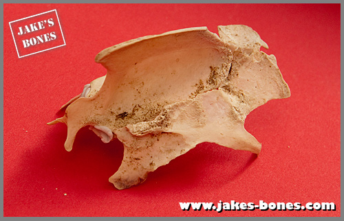 Strange bones #14: Two weird bone pathologies : Jake's Bones