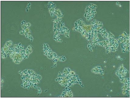 Microbiologie des boues activées | Traitement Des Eaux Usées
