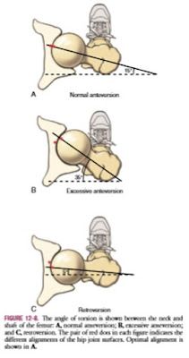 FISIOTERAPIA Y MOVIMIENTO CONCIENTE: SHAPE OF THE PROXIMAL FEMUR (Short ...