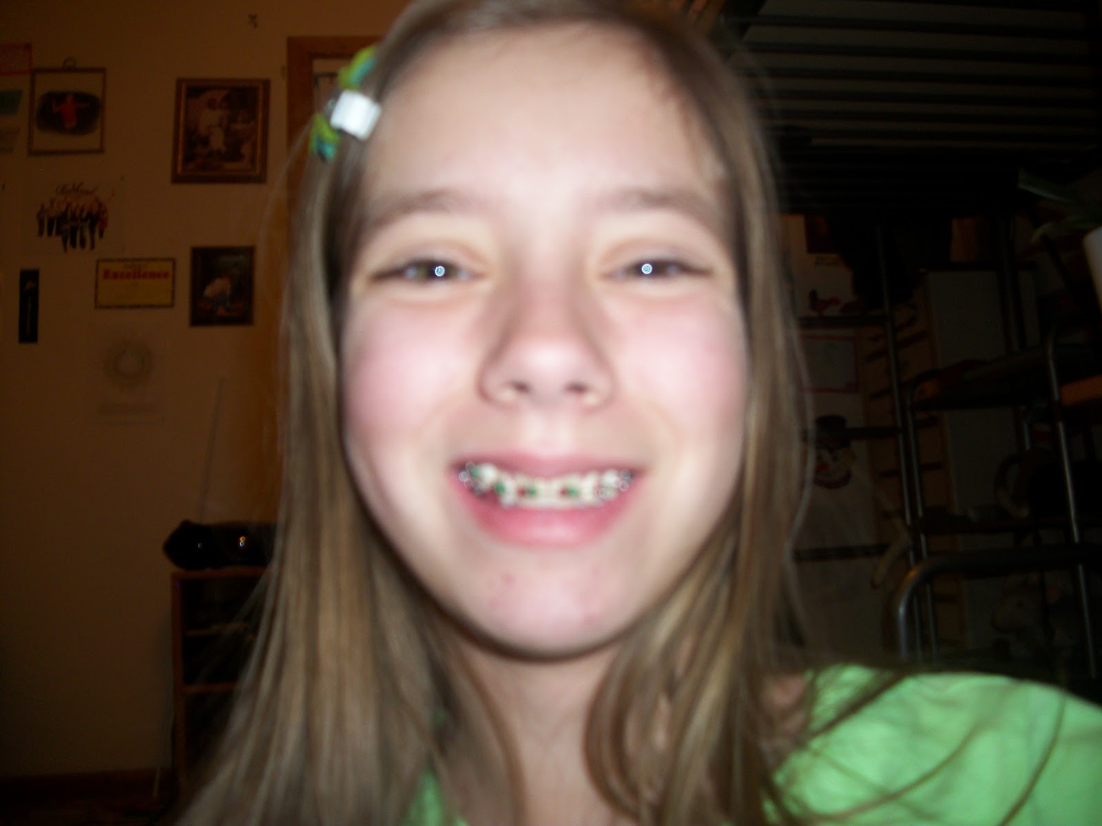 Life Through Ellie's Eyes: Braces