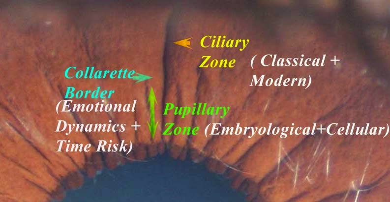 Modern And Multidimensional Iridology Radial Furrow At 360 In Modern