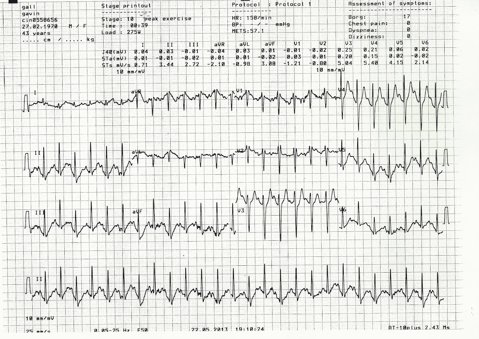 Dr Gall - the road to Ironman Switzerland, 2015: ECG Results...