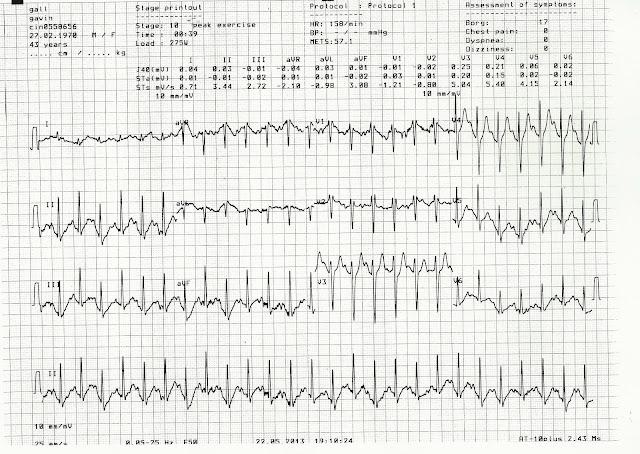 Dr Gall - the road to Ironman Switzerland, 2015: ECG Results...