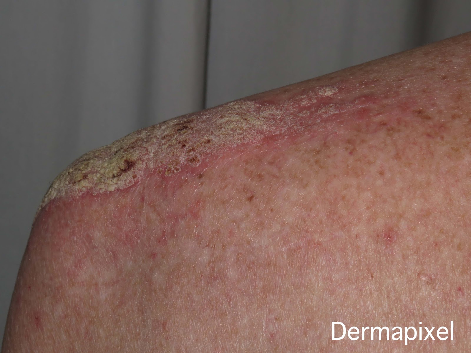 Dermapixel: enero 2019