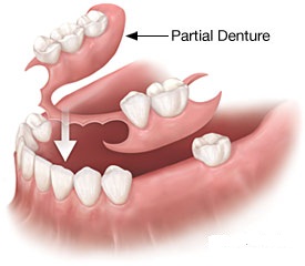 Comprehensive Exams: Partial Dentures