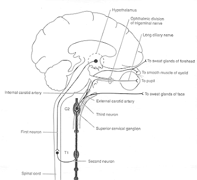 Zespół Hornera ~ Okulistyka Zwierząt
